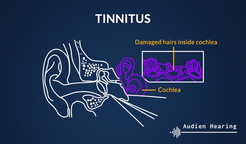 Comprehensive Tinnitus Guide | Audien Hearing