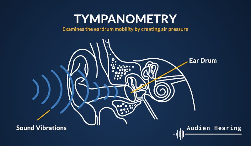 Tympanometry